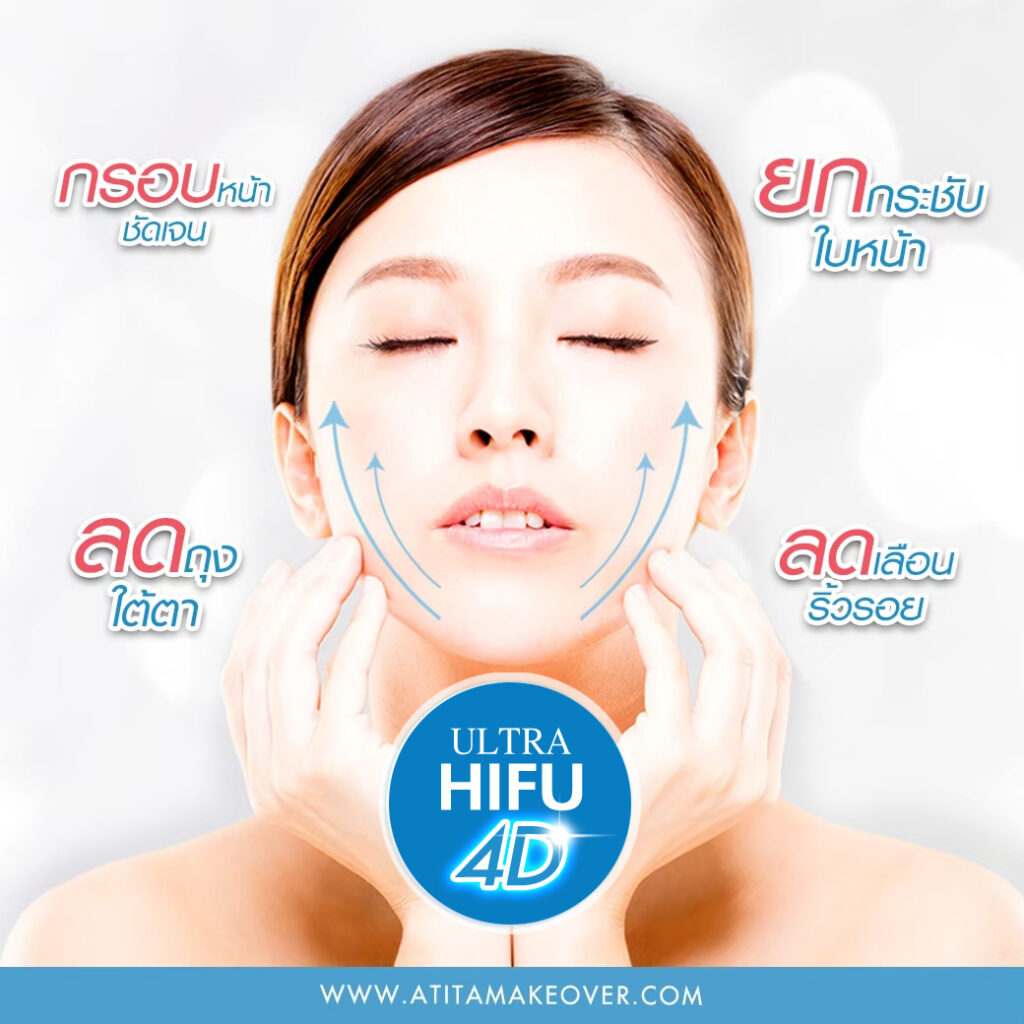 Ultra HIFU 4D - คลินิกเสริมความงาม ร้อยไหม ยกกระชับอันดับหนึ่ง