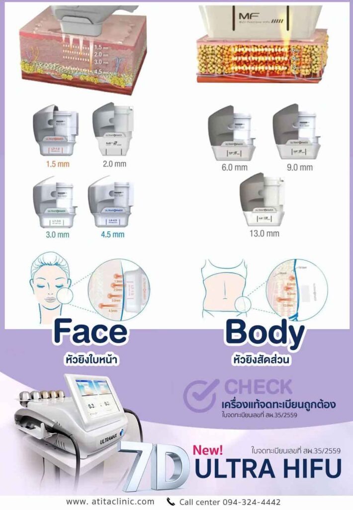HIFU ULTRAMAX 7D - คลินิกเสริมความงาม ร้อยไหม ยกกระชับอันดับหนึ่ง